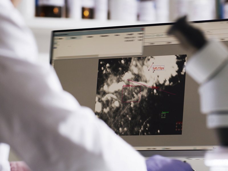 Cameras for microscopy imaging applications - Allied Vision