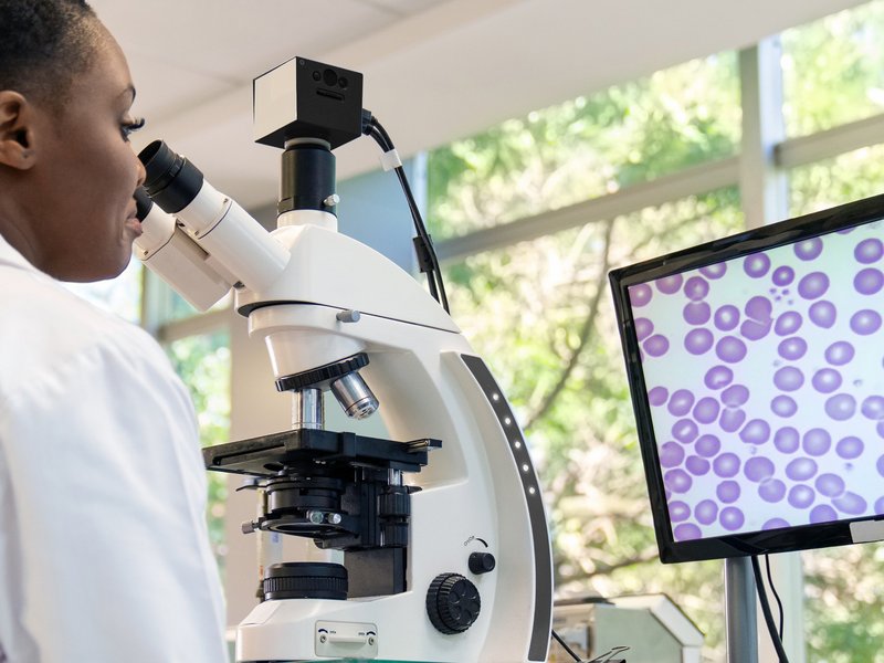 Cameras for microscopy imaging applications - Allied Vision